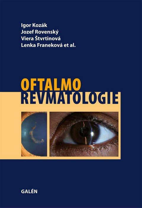 Oftalmorevmatologie - Igor Kozák a kol. od 299 Kč - Zbozi.cz
