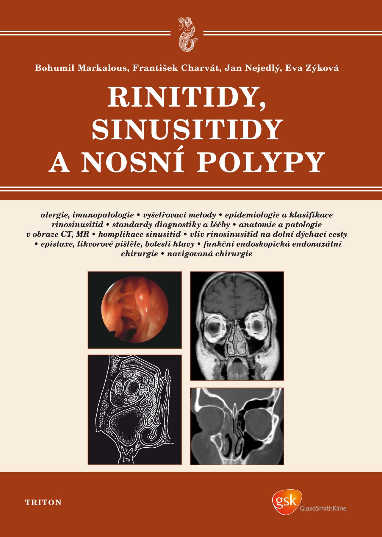 Rinitidy, sinusitidy a nosní polypy - Bohumil Markalous, František ...