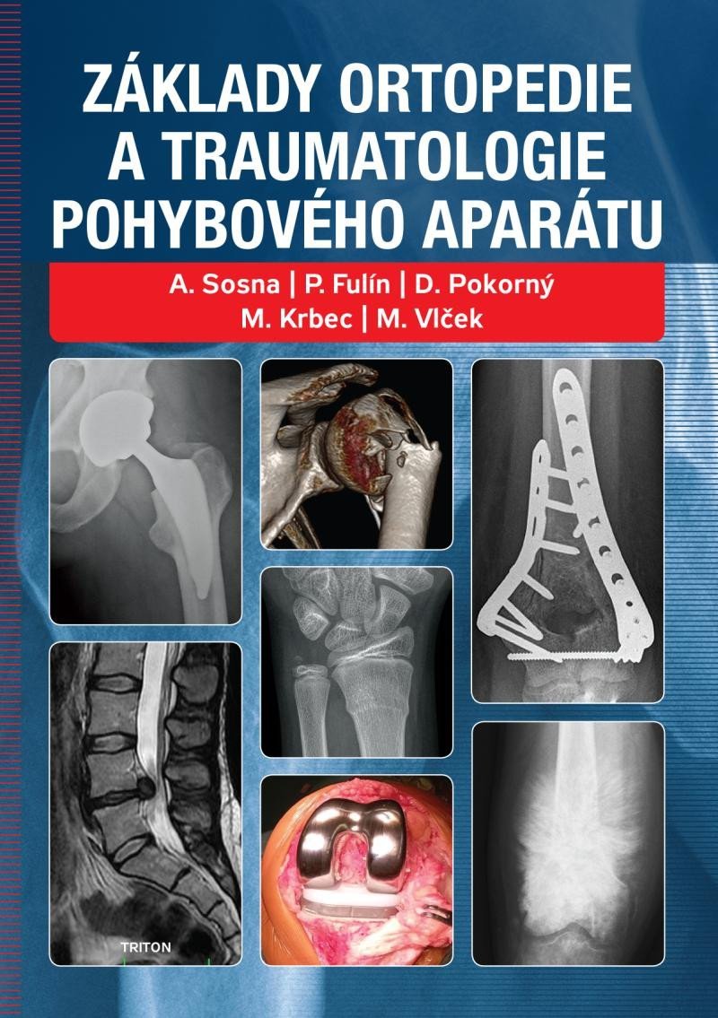 Základy ortopedie a traumatologie pohybového aparátu - Antonín Sosna a kolektiv (2024, pevná) od ...